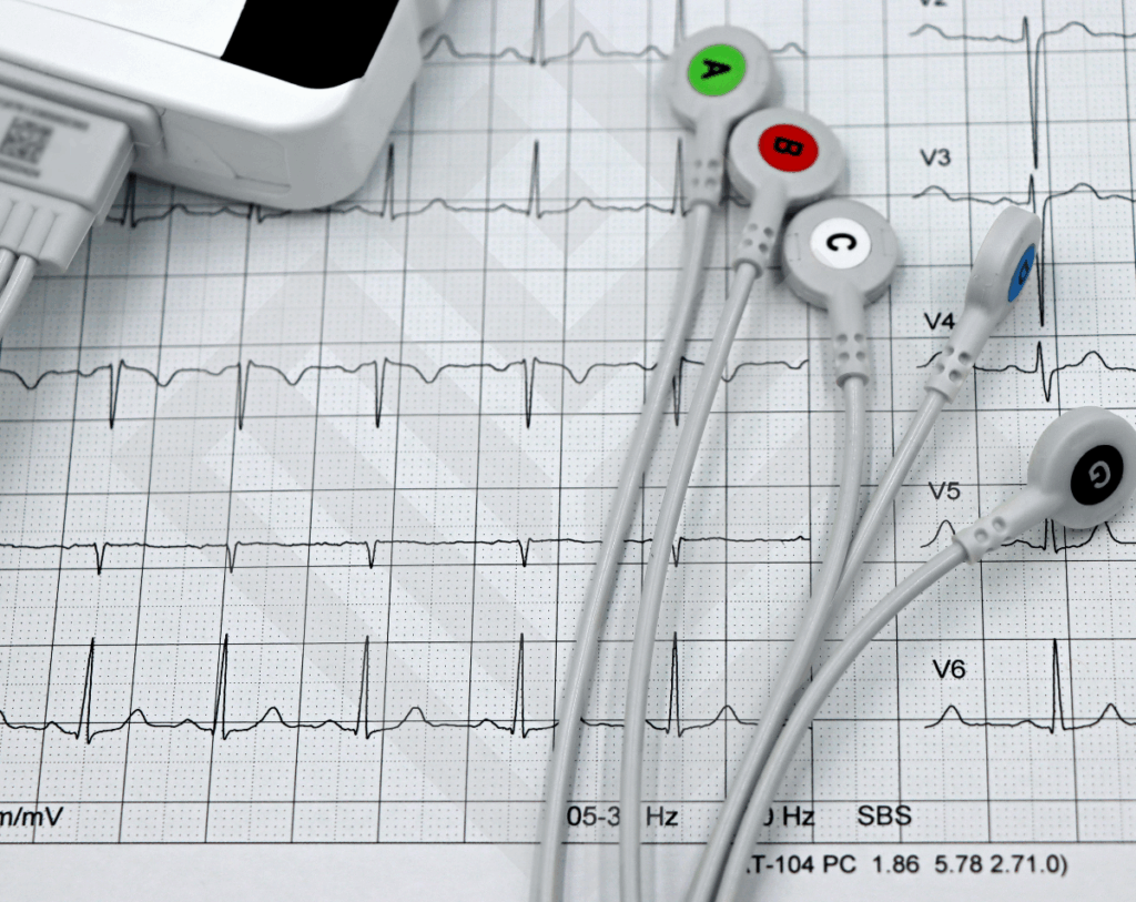 Electrocardiogram (EKG/ECG) Test - Desert Mobile Medical