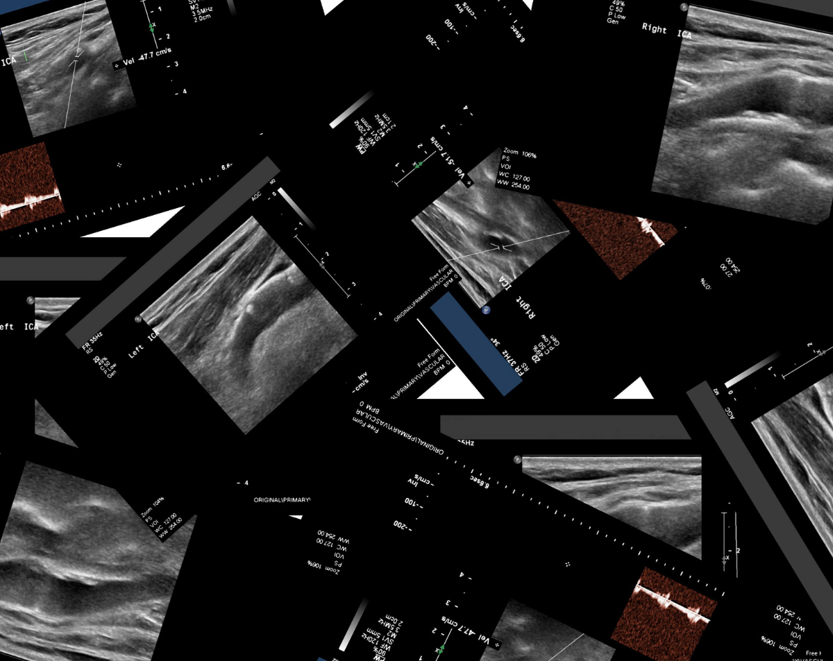 Mobile LE Venous Ultrasound at Home: Desert Mobile Medical